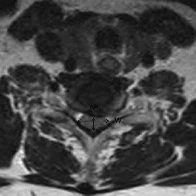 Image result for Tromner Sign Demonstration