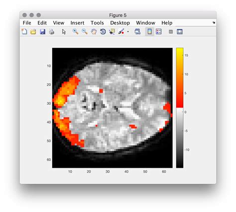 Image result for Python MATLAB Brain Surface