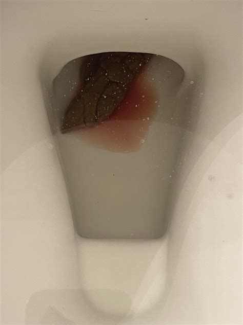 Image result for Red Poop Beets