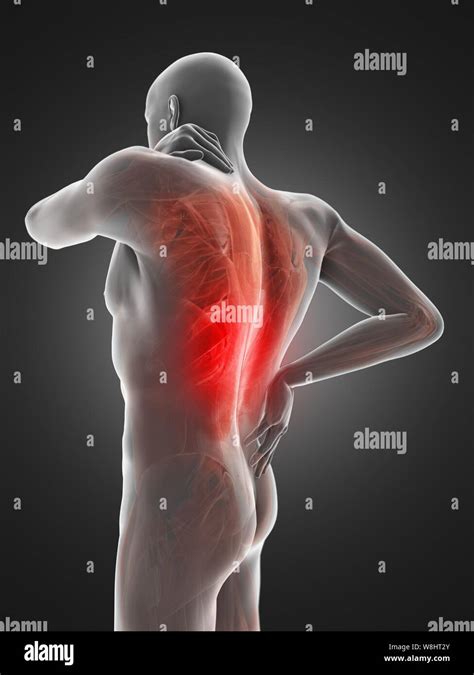 Image result for Back Pain in Computer