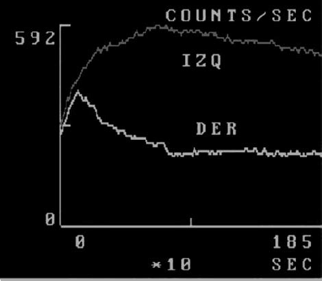 Image result for Nephrogram Phase Timing