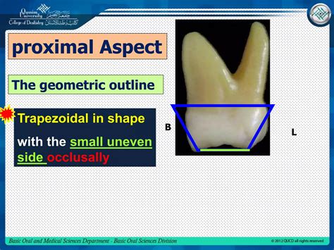 Image result for Maxillary First Molar