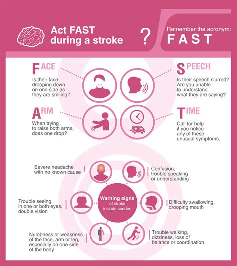 Image result for Fast Stroke