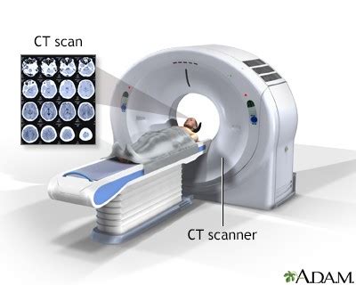 Image result for How CT Scanning Works
