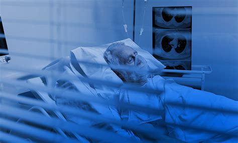 Image result for Non-Invasive Intubation