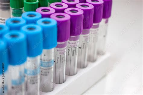 Image result for Tube Testing