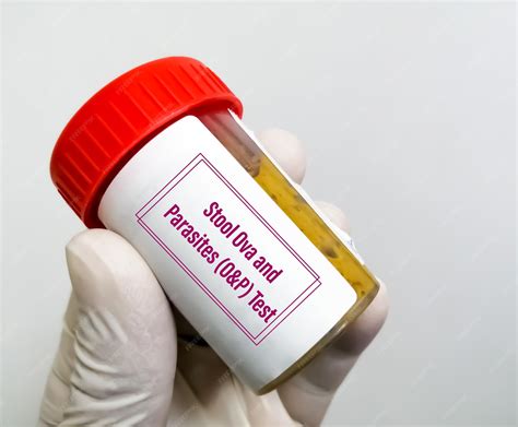 Image result for Stool Sample Test