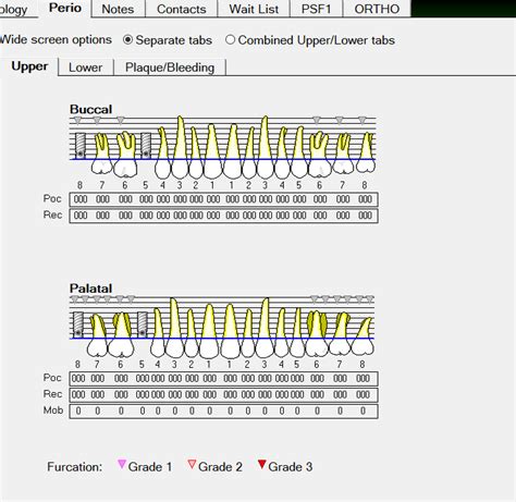 Image result for Paper Perio Chart