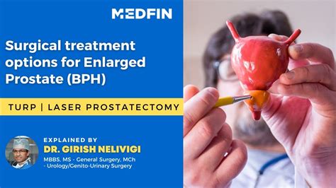 Image result for Prostate Operation Procedure