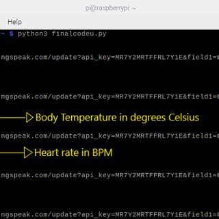 Image result for Health Monitoring Arduino