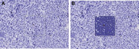 Image result for Multiplex IHC Texture Types Diffuse