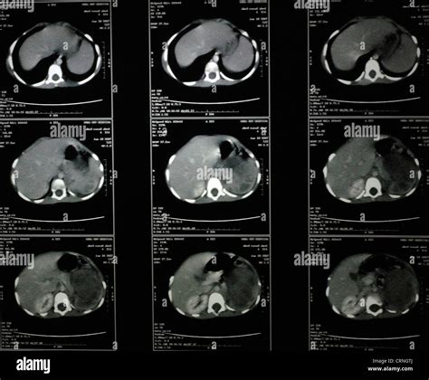 Image result for Cat Scan