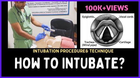 Image result for Intubate