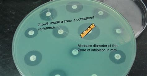 Image result for Disadvantages of Using Disk Diffusion Method
