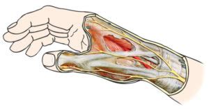 Image result for Hand Dissection
