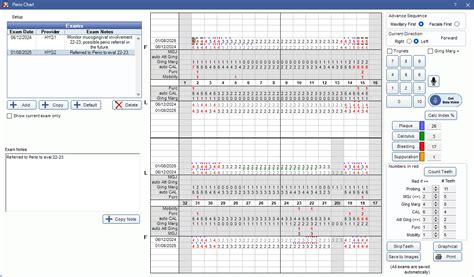 Image result for Paper Perio Chart