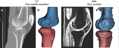 Image result for Image Processing Algorithm for DICOM Images