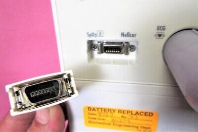 Image result for ECG SpO2 Nibp