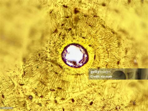 Image result for Compact Bone Cross Section