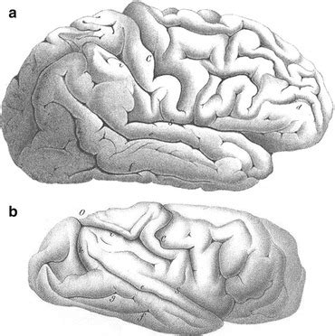 Image result for The Function of the Wernicke Connection