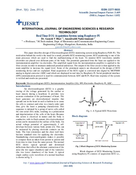 Image result for Wireless ECG Monitor Using Raspberry Pi