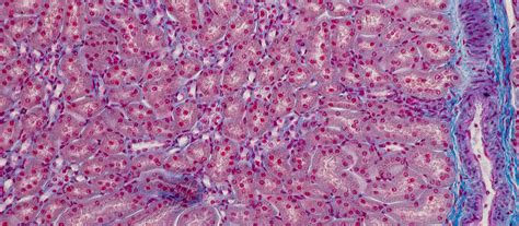 Image result for Multiplex IHC