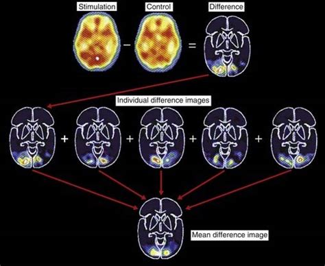 Image result for Cell Cortex
