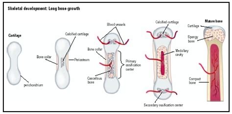 Image result for Types of Abnormal Bone Formation