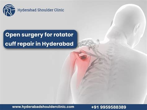 Image result for Rotator Cuff Repair Surgery