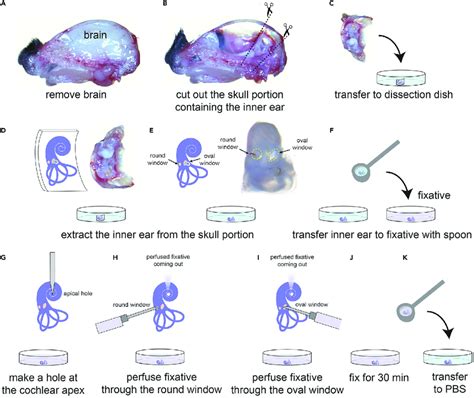 Image result for Ear Dissection Labeled