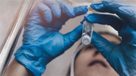 Image result for Fluid Balance Chart OSCE