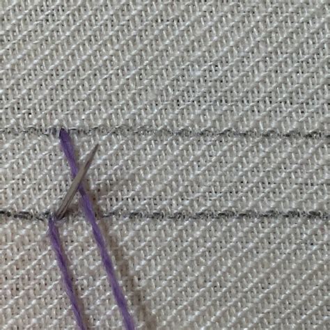 Image result for Buttonhole Invagination