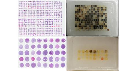 Image result for Tissue Microarray Multiplex IHC NCR