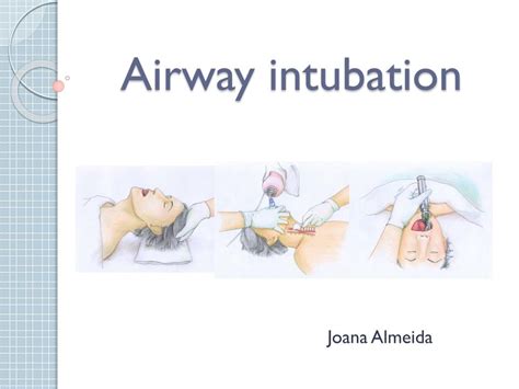 Image result for Intubation PowerPoint Presentation