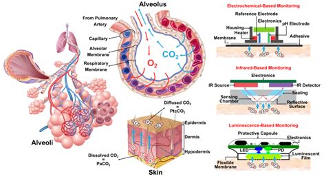 Image result for TCO2 Monitoring