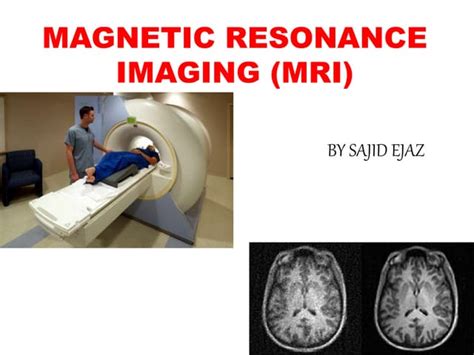 Image result for Components of MRI