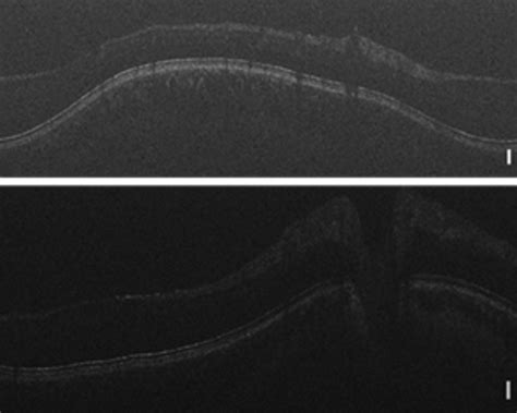 Image result for Oct Axial Resolution