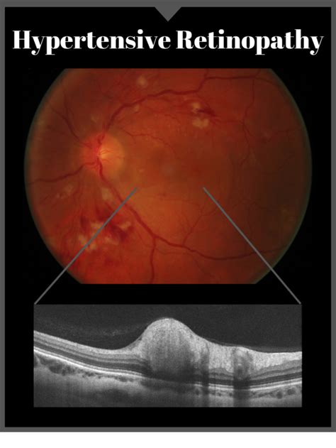 Image result for Retinal Imaging