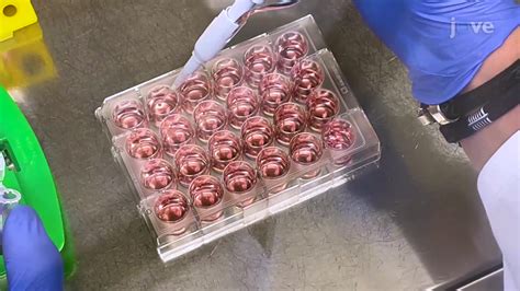 Image result for Neuronal Reprogramming