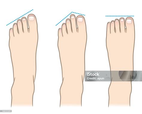 Image result for Different Types of Toes