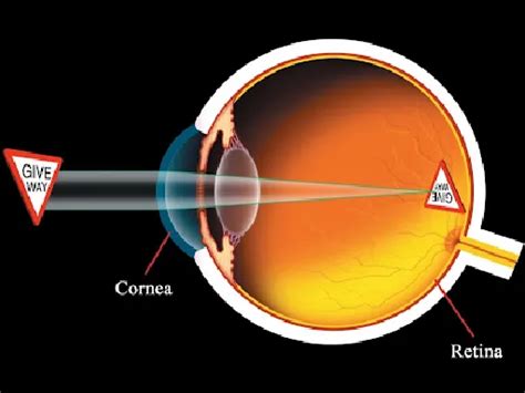 Image result for Hard SF Visual System