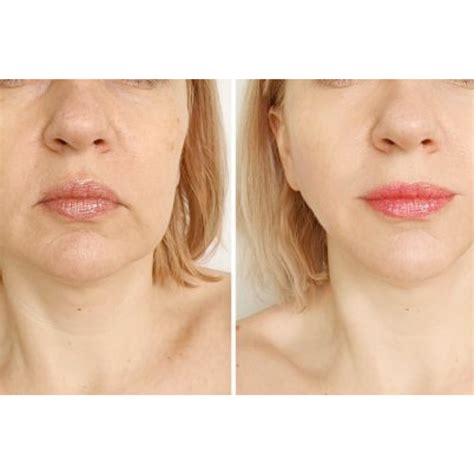 Image result for Cheek Threading