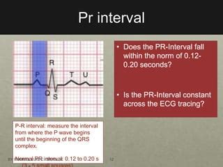Image result for normal pr interval ecg