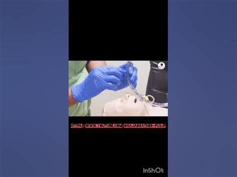 Image result for Intubate Procedure