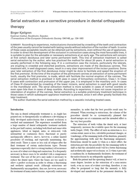 Image result for Serial Extraction Process