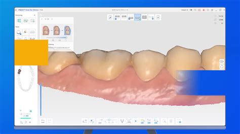 Image result for Medit Software