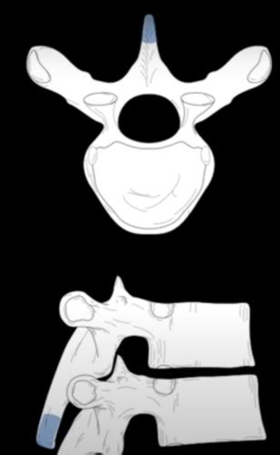 Image result for Sharp Slender Process