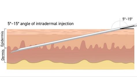 Image result for Injection Monkey
