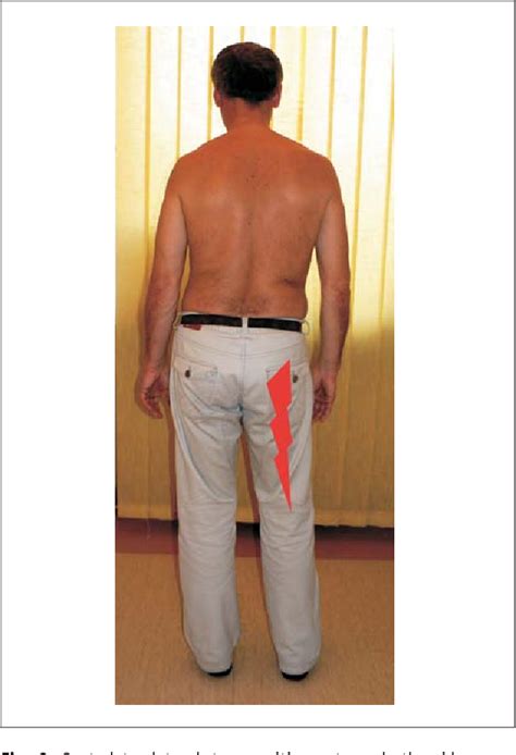 Image result for Discus Block Leg