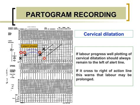 Image result for Partogram Paper